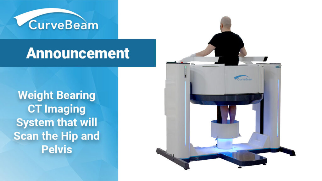 CurveBeam Announces Development of Weight Bearing CT Imaging System that will Scan the Hip and ...