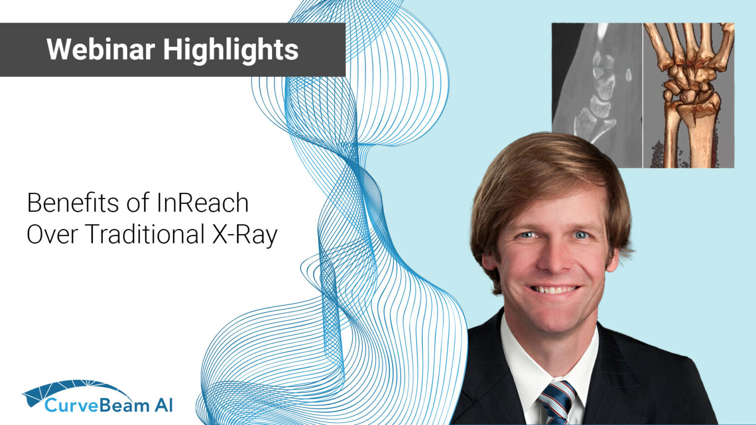 Benefits of InReach over Traditional X-Ray by Dr. Gaston - CurveBeam AI