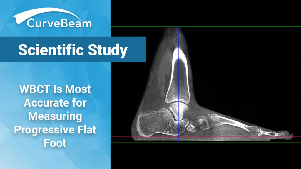 Researchers Find Two WBCT Measurements that Diagnose PCFD Almost ...