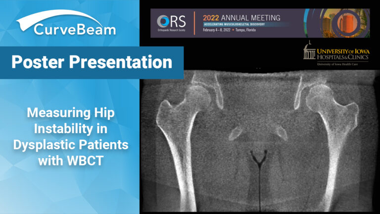 Measuring Hip Instability in Dysplastic Patients with WBCT - CurveBeam AI