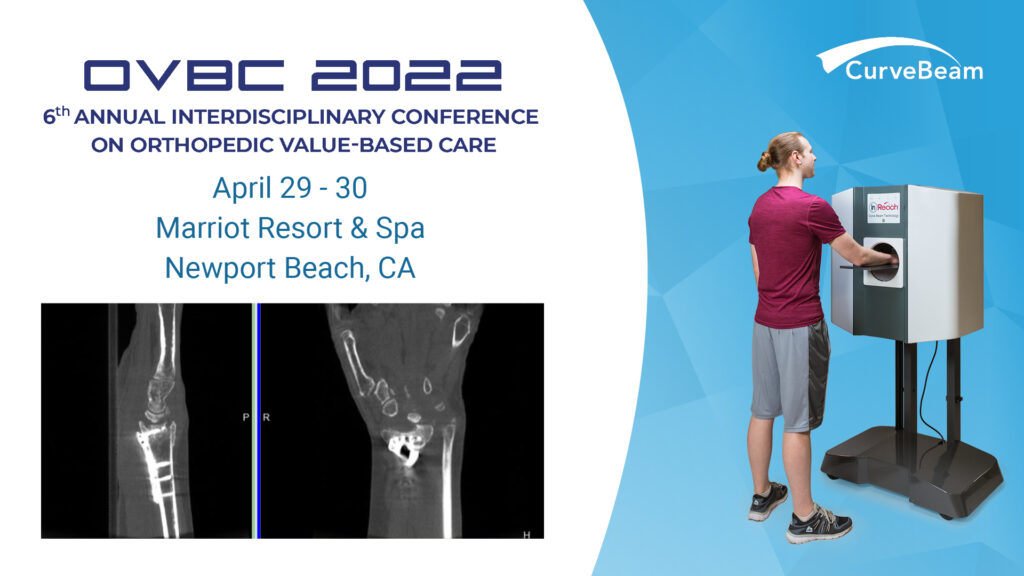 OVBC 2022 - CurveBeam AI
