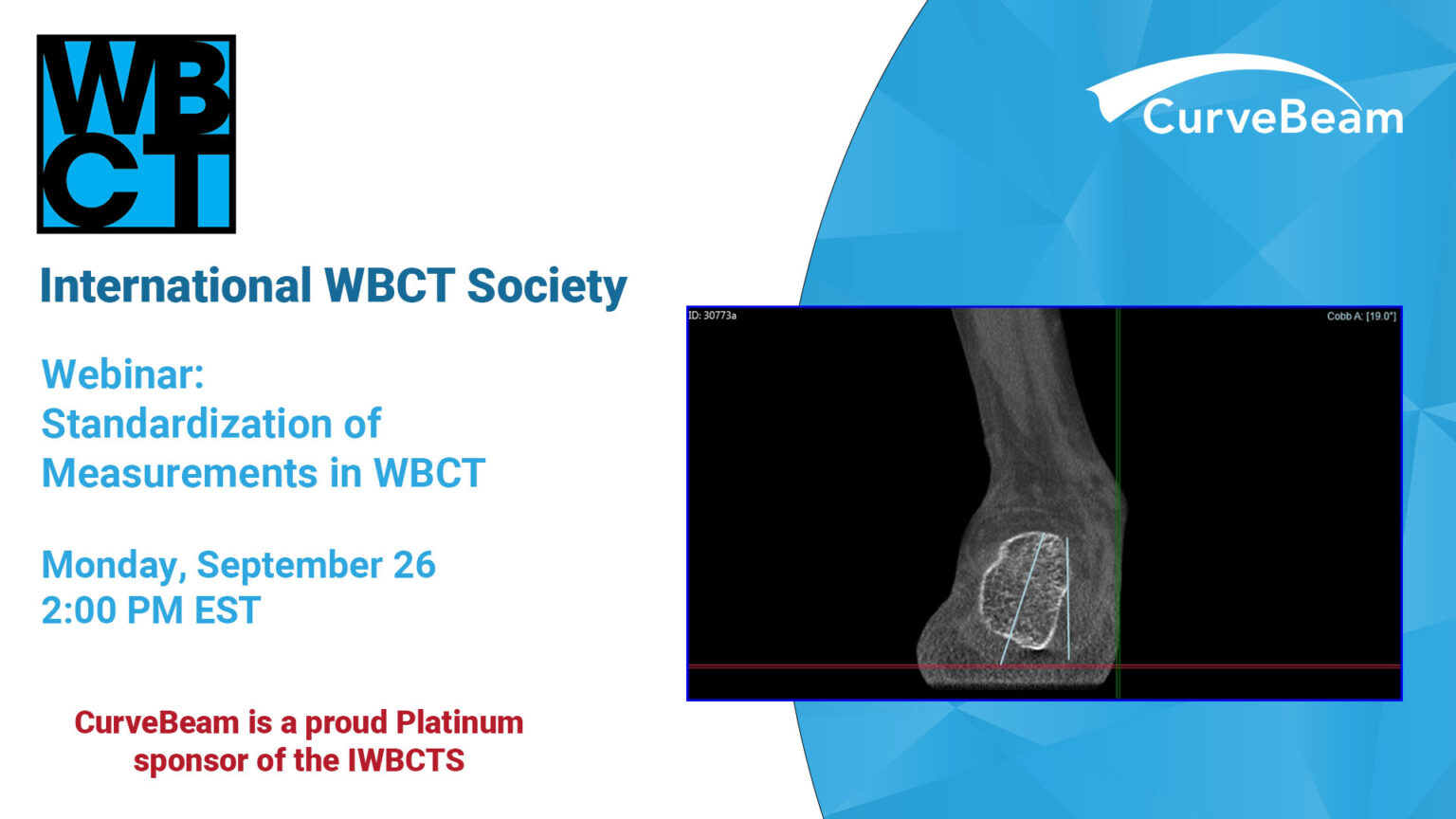 IWBCTS Webinar: Standardization of Measurements in WBCT - CurveBeam AI