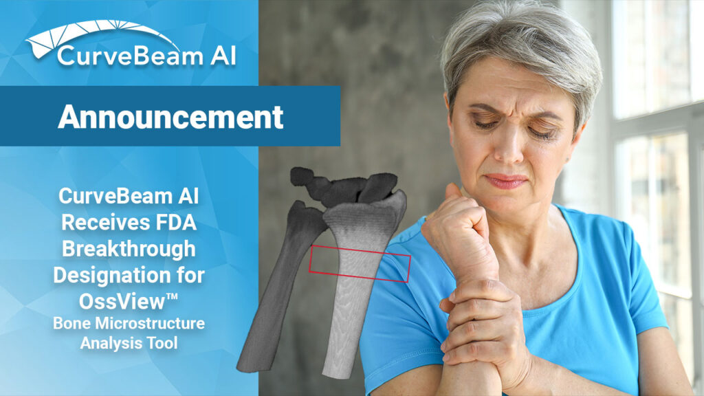 FDA Grants Breakthrough Device Designation for CurveBeam AI’s OssView™ Bone Fragility Software ...