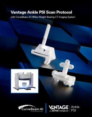 HiRise Exactech Vantage Protocol Guide - CurveBeam AI