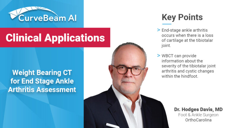 CurveBeam AI - bilateral, weight bearing 3D views of the foot, ankle ...