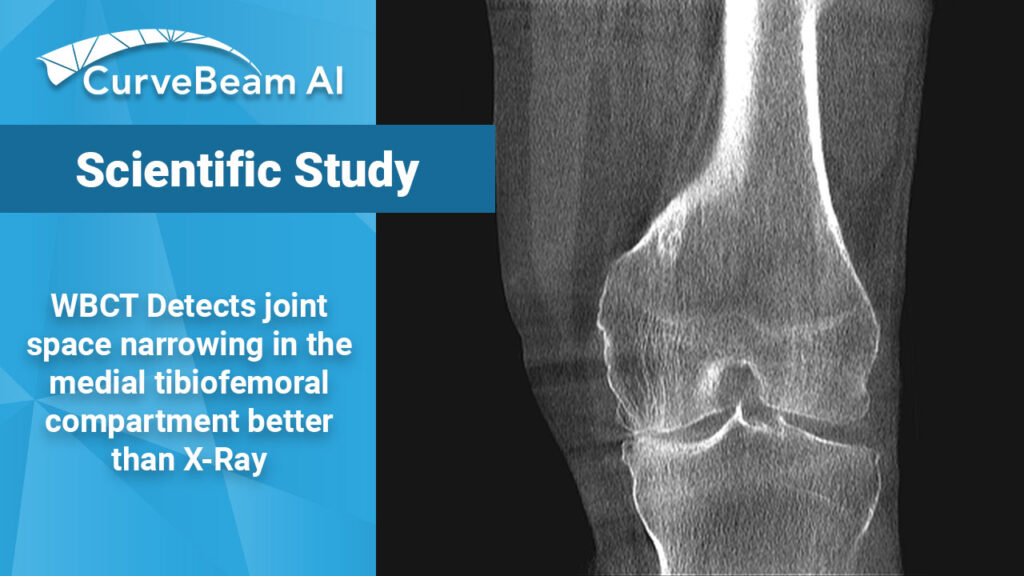 WBCT Better Detects Changes in Knee Joint Space Width than X-Ray in OA ...