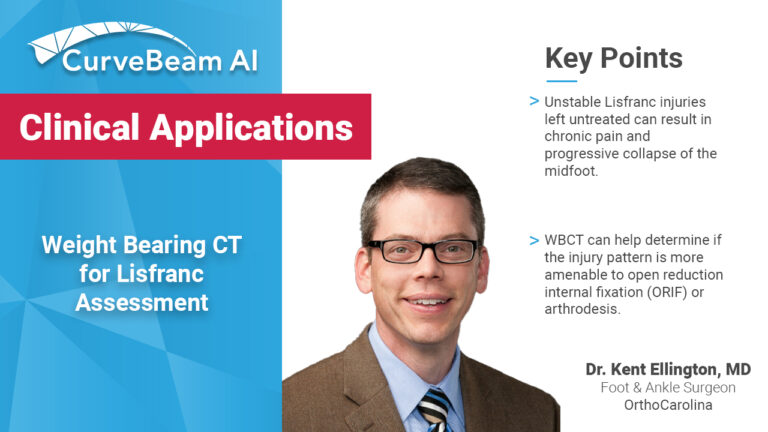 CurveBeam AI - bilateral, weight bearing 3D views of the foot, ankle ...