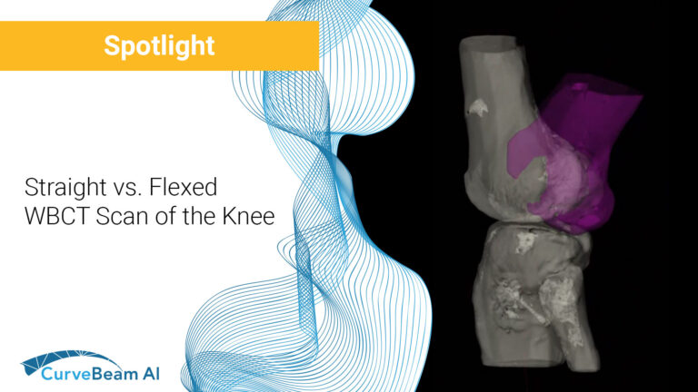 Media - CurveBeam AI