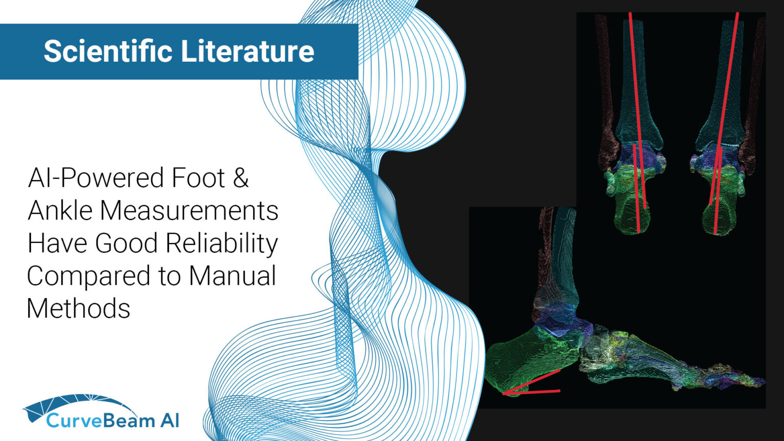 CurveBeam AI's AI-Powered Foot & Ankle Measurements Have Good ...