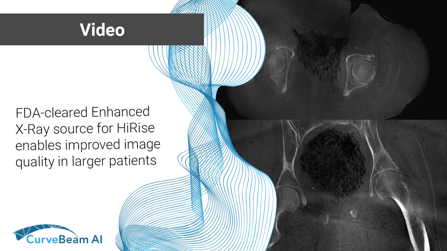 CurveBeam AI - bilateral, weight bearing 3D views of the foot, ankle ...