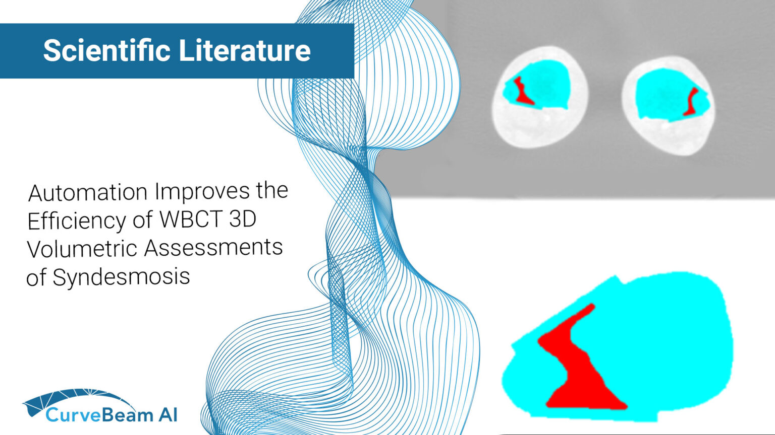 CurveBeam AI - bilateral, weight bearing 3D views of the foot, ankle ...