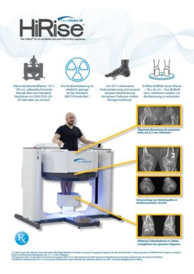 Dépliant HiRise - CurveBeam AI