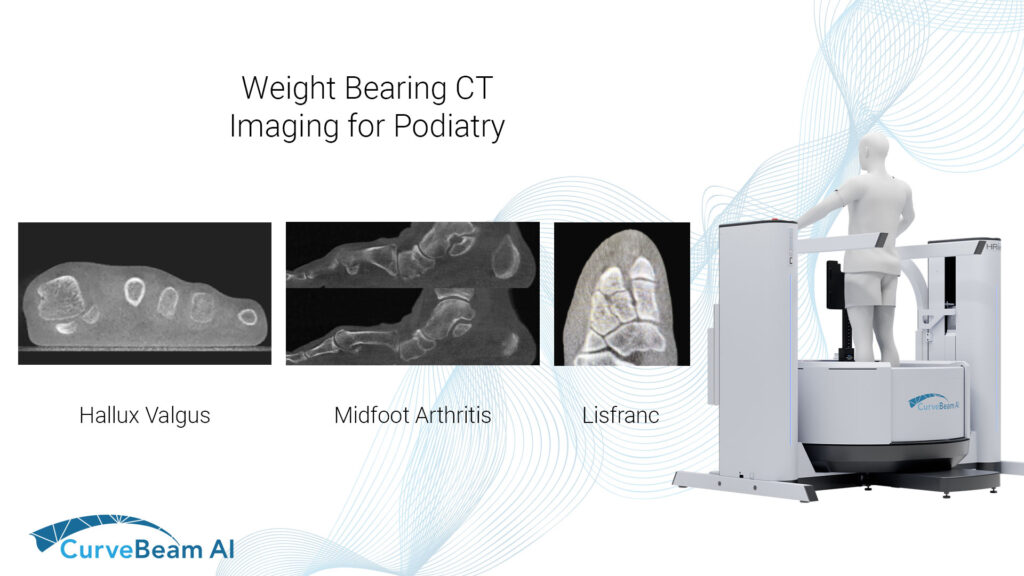 Weight Bearing CT Imaging for Podiatry - CurveBeam AI
